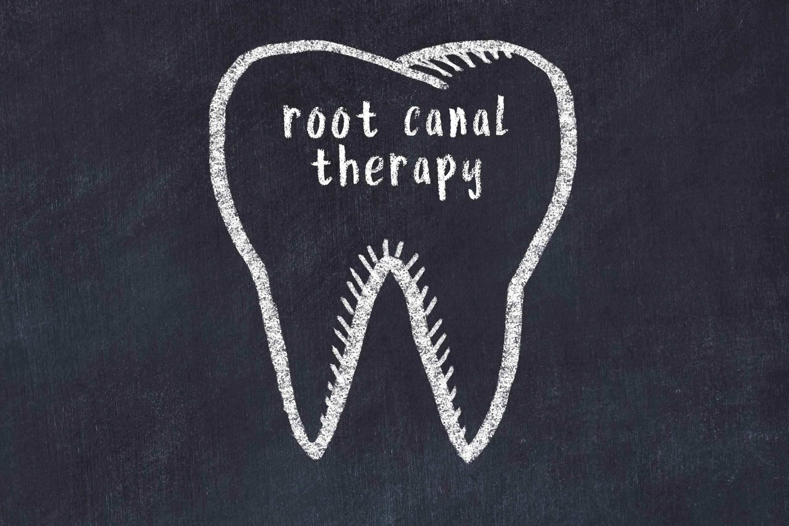 What Is A Root Canal Landmark Dental Arts